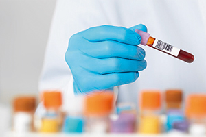 Cardiac Risk Stratification | Core Laboratory at Abbott