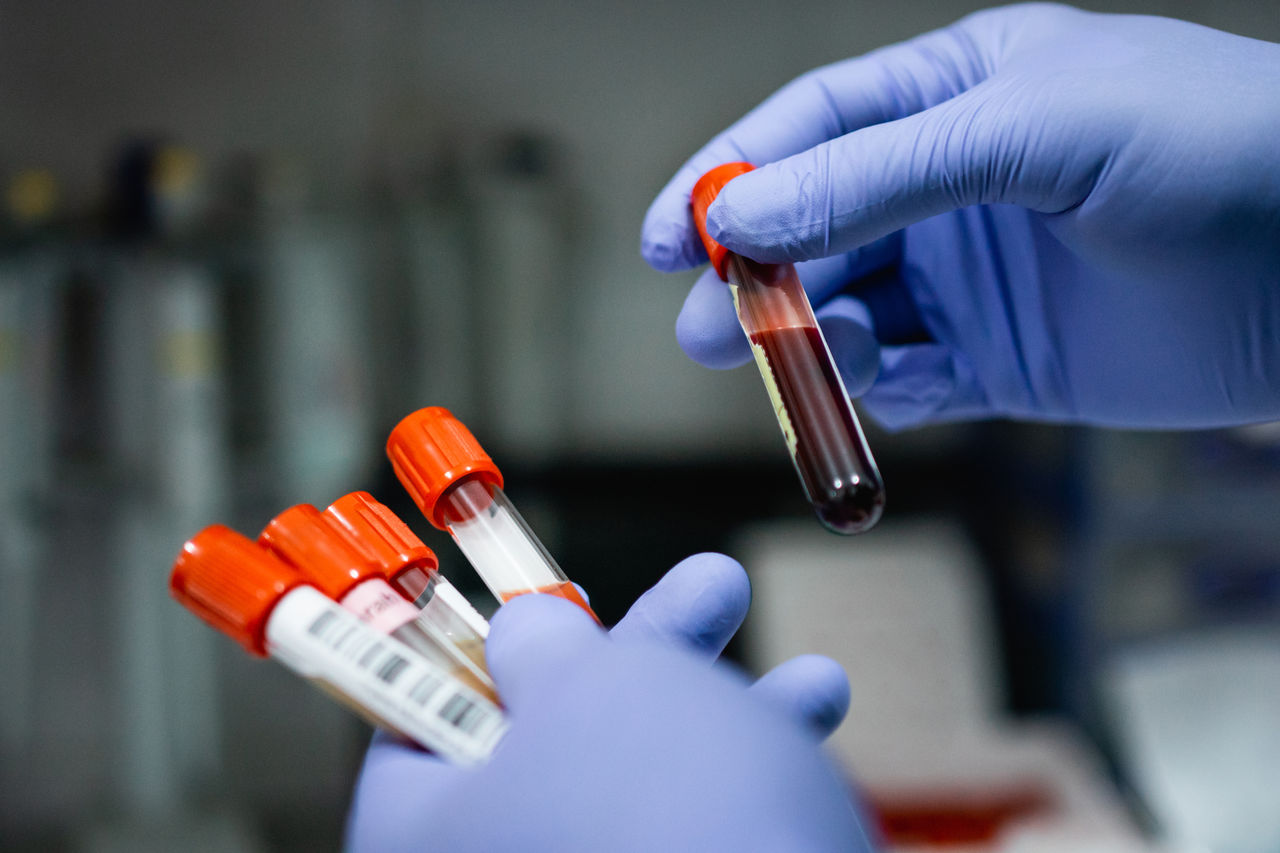 Maintaining Lab Efficiency During Lab Modernization | Core Laboratory ...